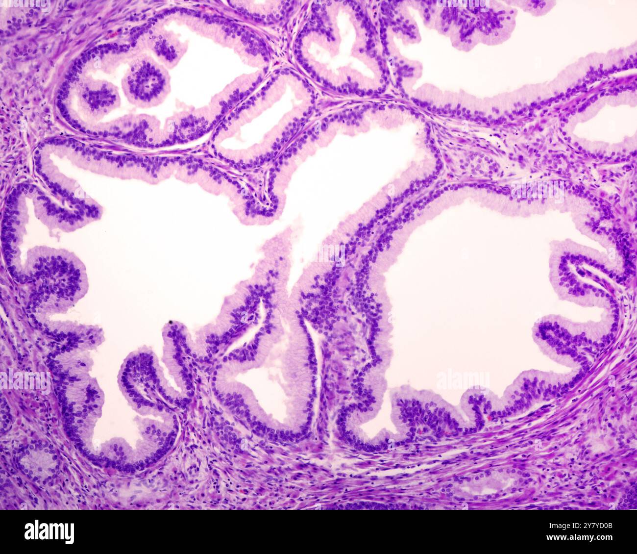 Light micrograph showing a prostate gland lined by a simple columnar ...
