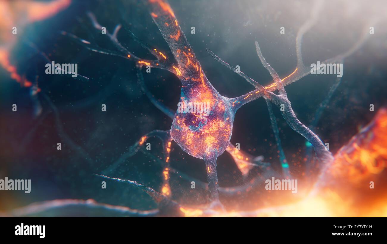 Tau and neurofibrillary tangles, illustration Stock Photo - Alamy