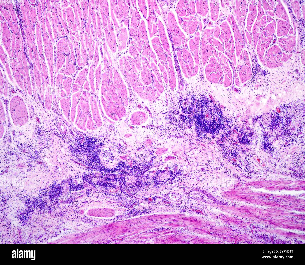 Light micrograph of the muscular layer of the digestive system. There ...