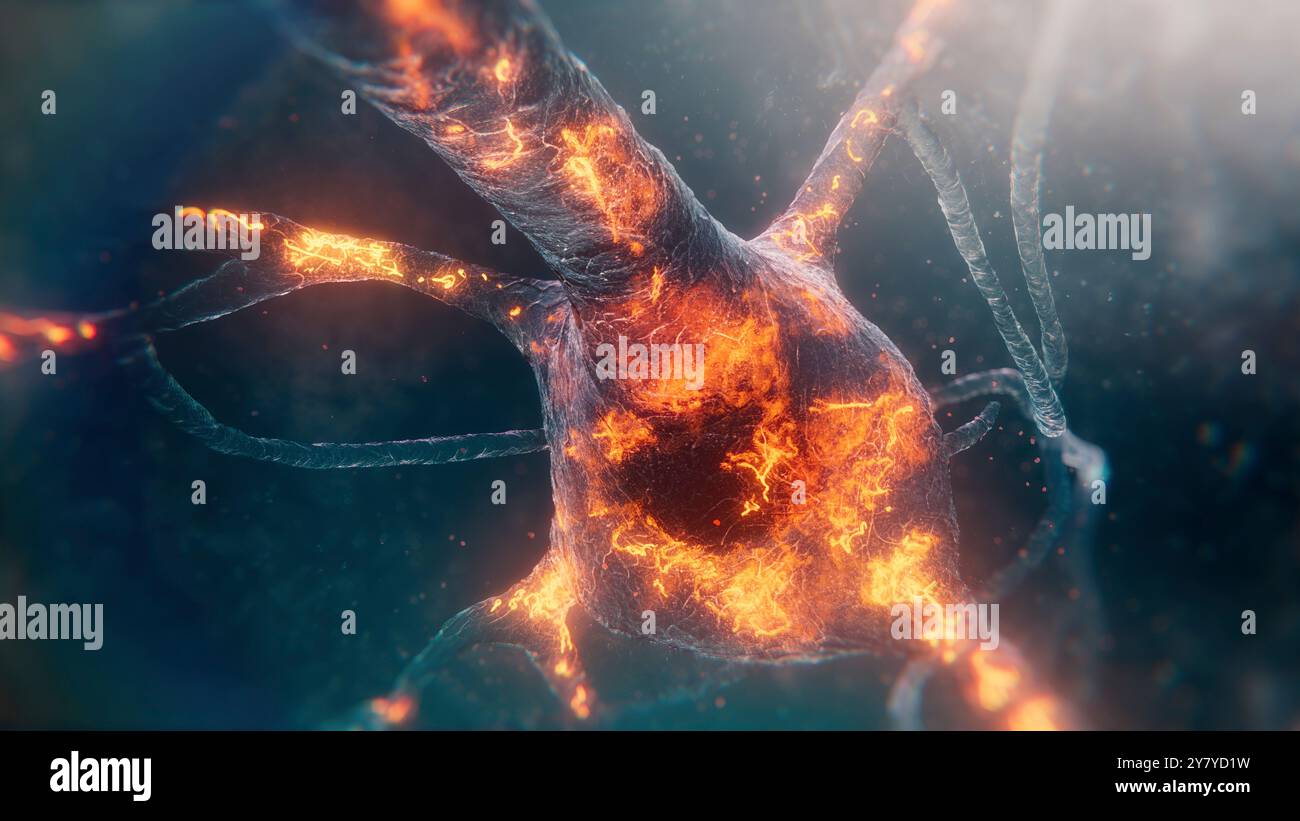 Illustration of tau and neurofibrillary tangles in a neuron (nerve cell ...