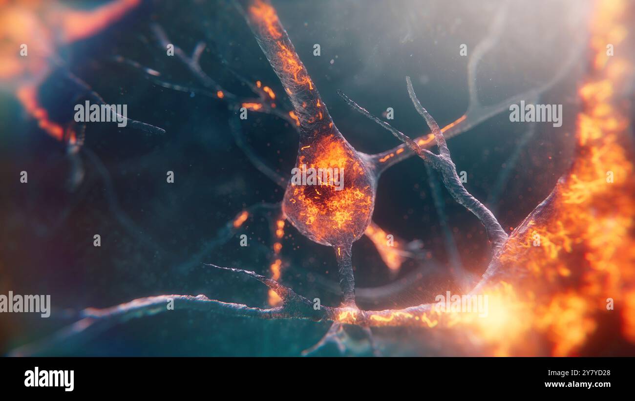 Tau and neurofibrillary tangles, illustration Stock Photo - Alamy