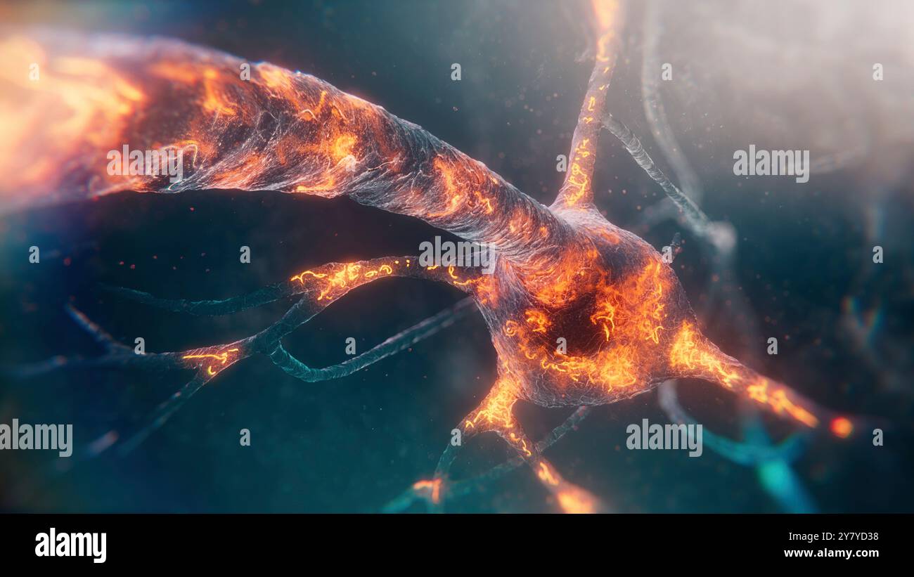 Tau and neurofibrillary tangles, illustration Stock Photo - Alamy