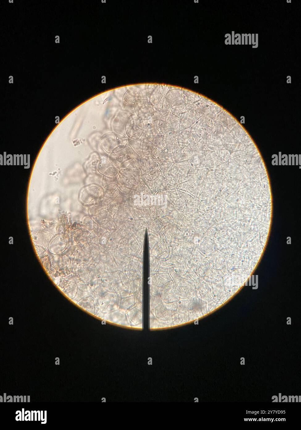Light micrograph of fungal hyphae (threads) in a sample taken from a ...