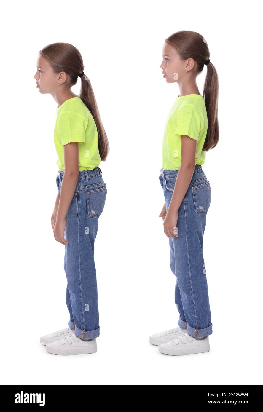 Good and bad posture, collage. Girl standing on white background, side ...