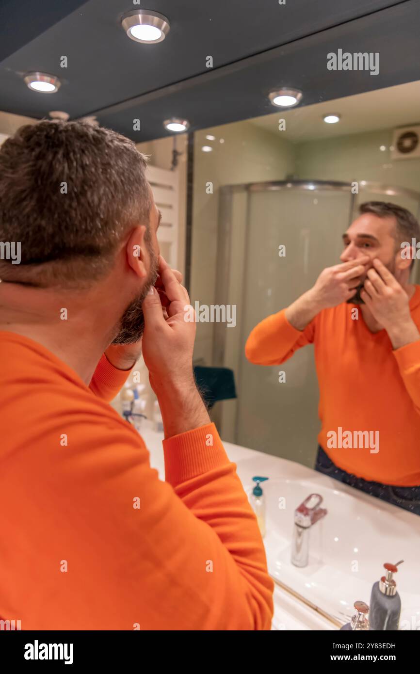 Adult man investigating his pimples on face. Guy trying to get rid of ...