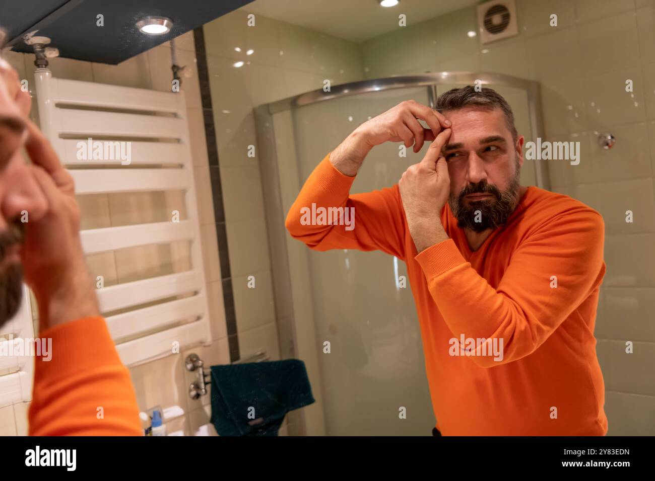 Adult man investigating his pimples on face. Guy trying to get rid of ...