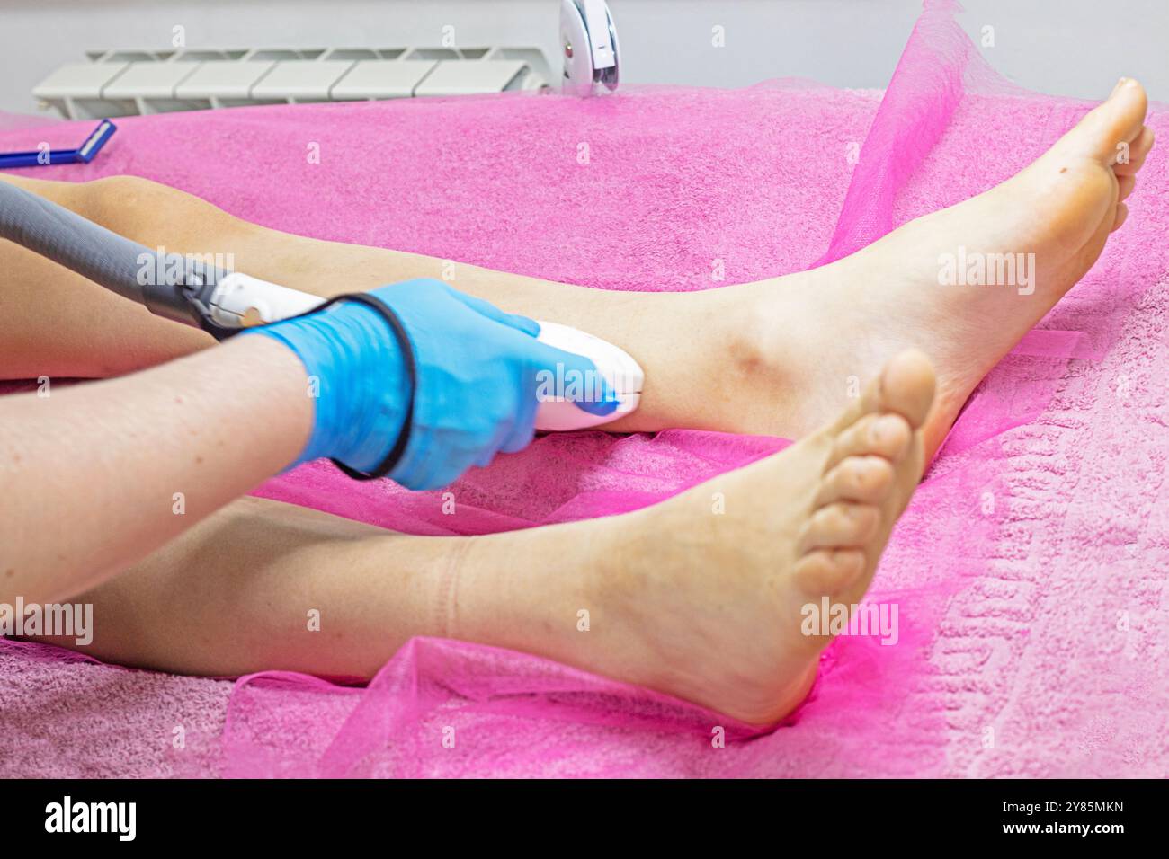 Laser vacuum device remove hi-res stock photography and images - Alamy