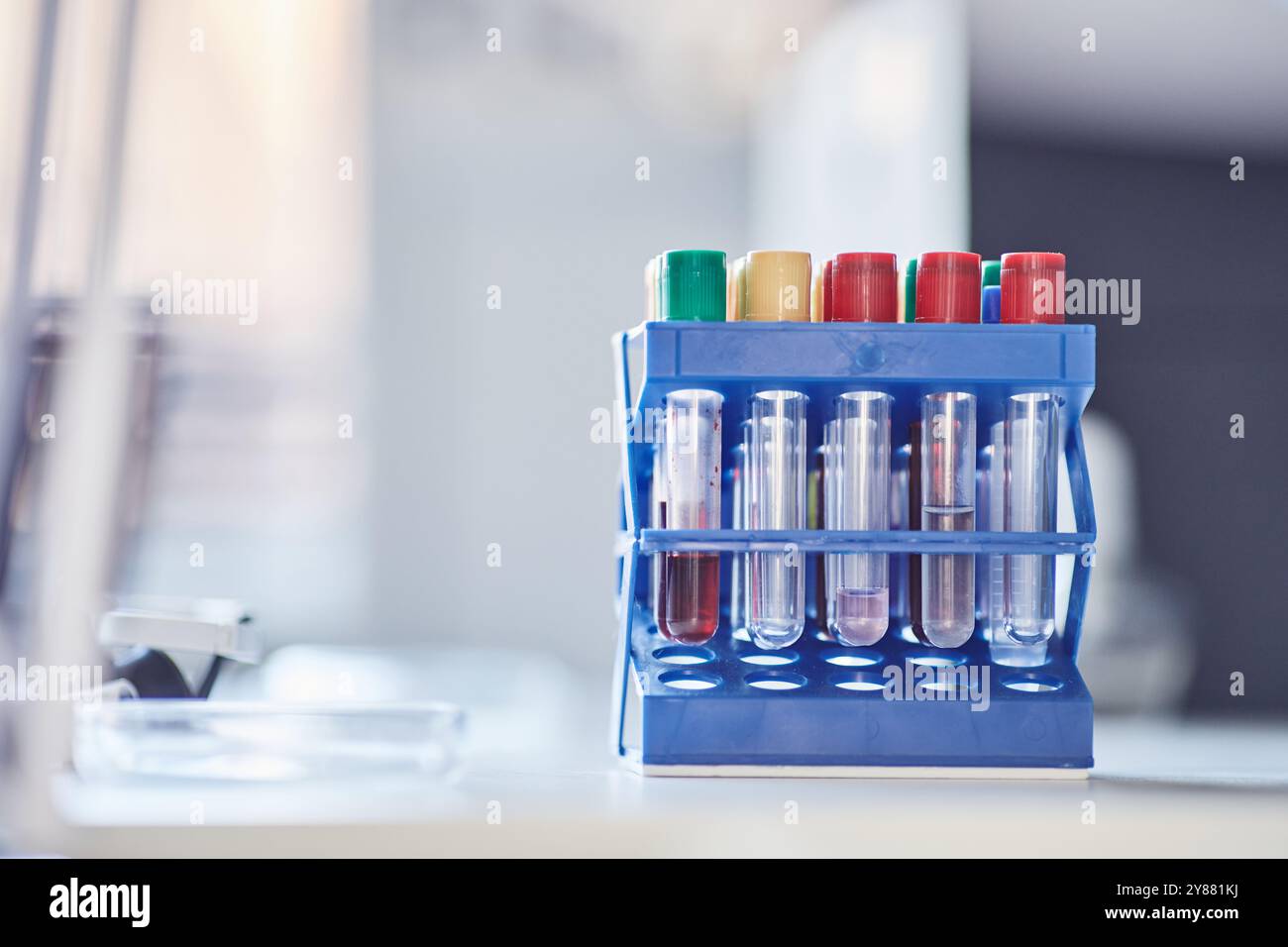 Close up on multiple samples with chemicals on plastic test tube rack ...