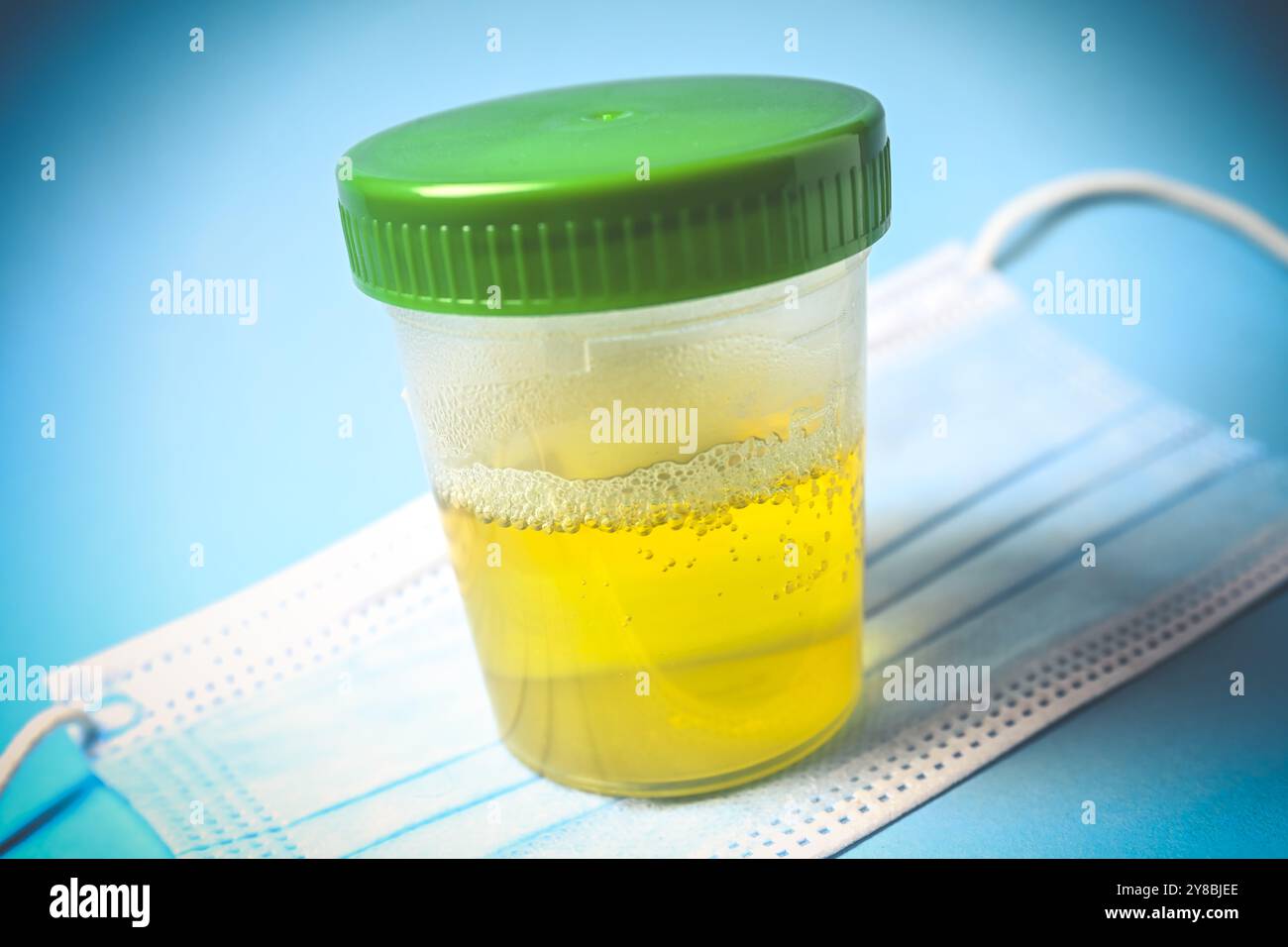 urine sample, Urinprobe Stock Photo - Alamy