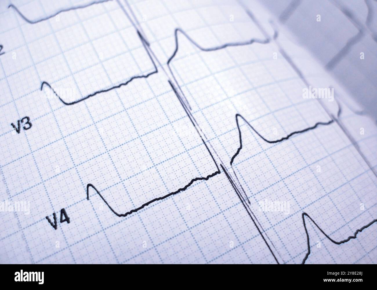 Cardiograph hi-res stock photography and images - Alamy