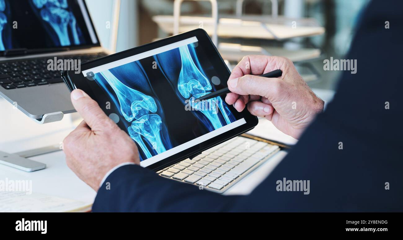 Hands, bone scan and tablet screen for patient record for healthcare or ...