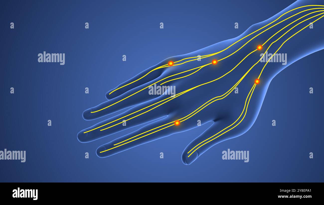 Tingling nerve in the hand Stock Photo - Alamy