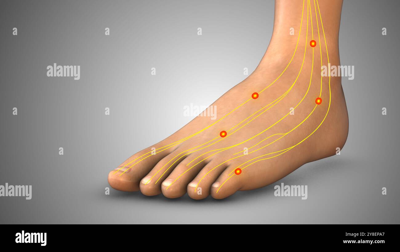 Numbness and tingling in foot Stock Photo - Alamy