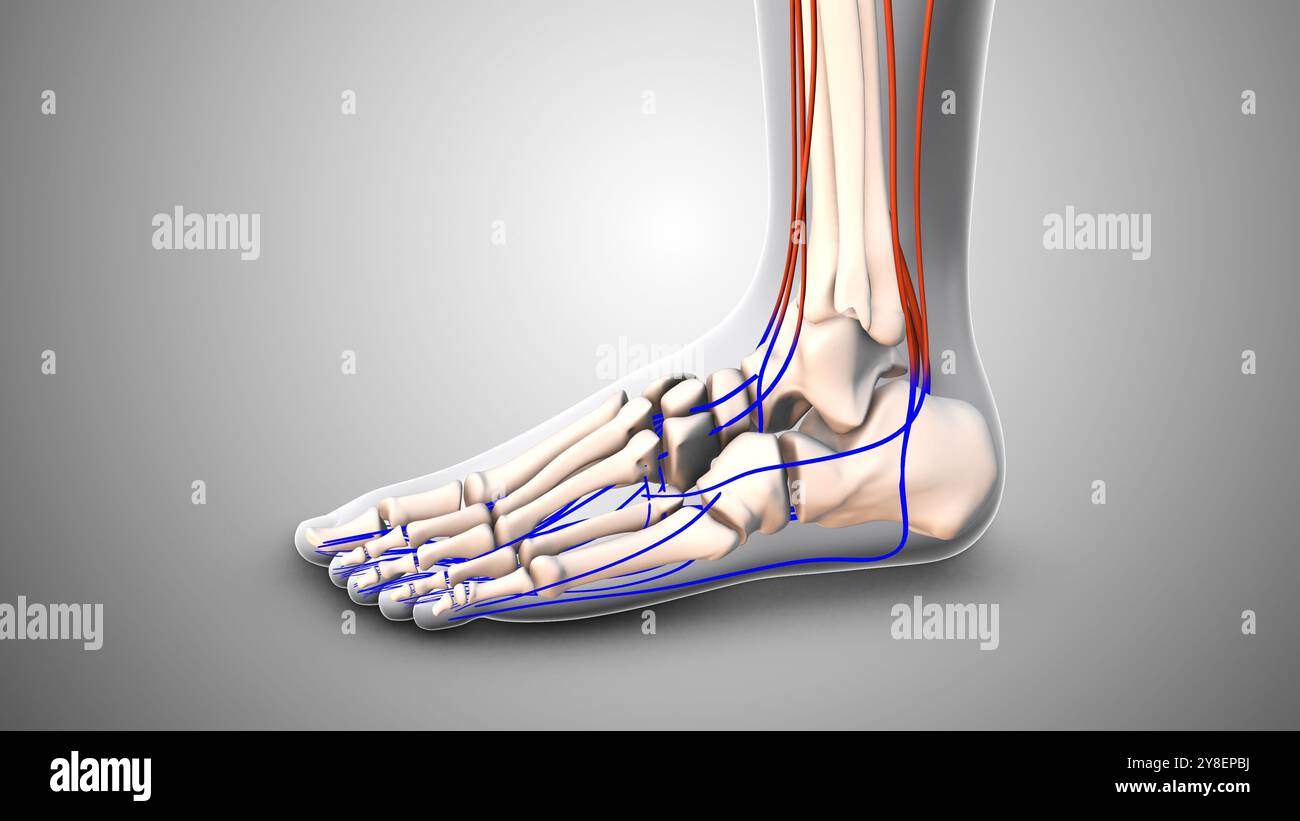 Diabetic blood vessel damage in the feet Stock Photo - Alamy