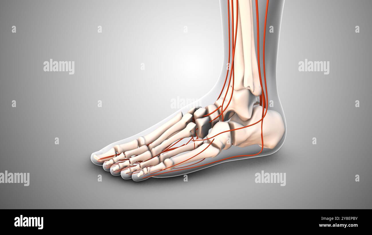 Diabetic blood vessel damage in the feet Stock Photo - Alamy