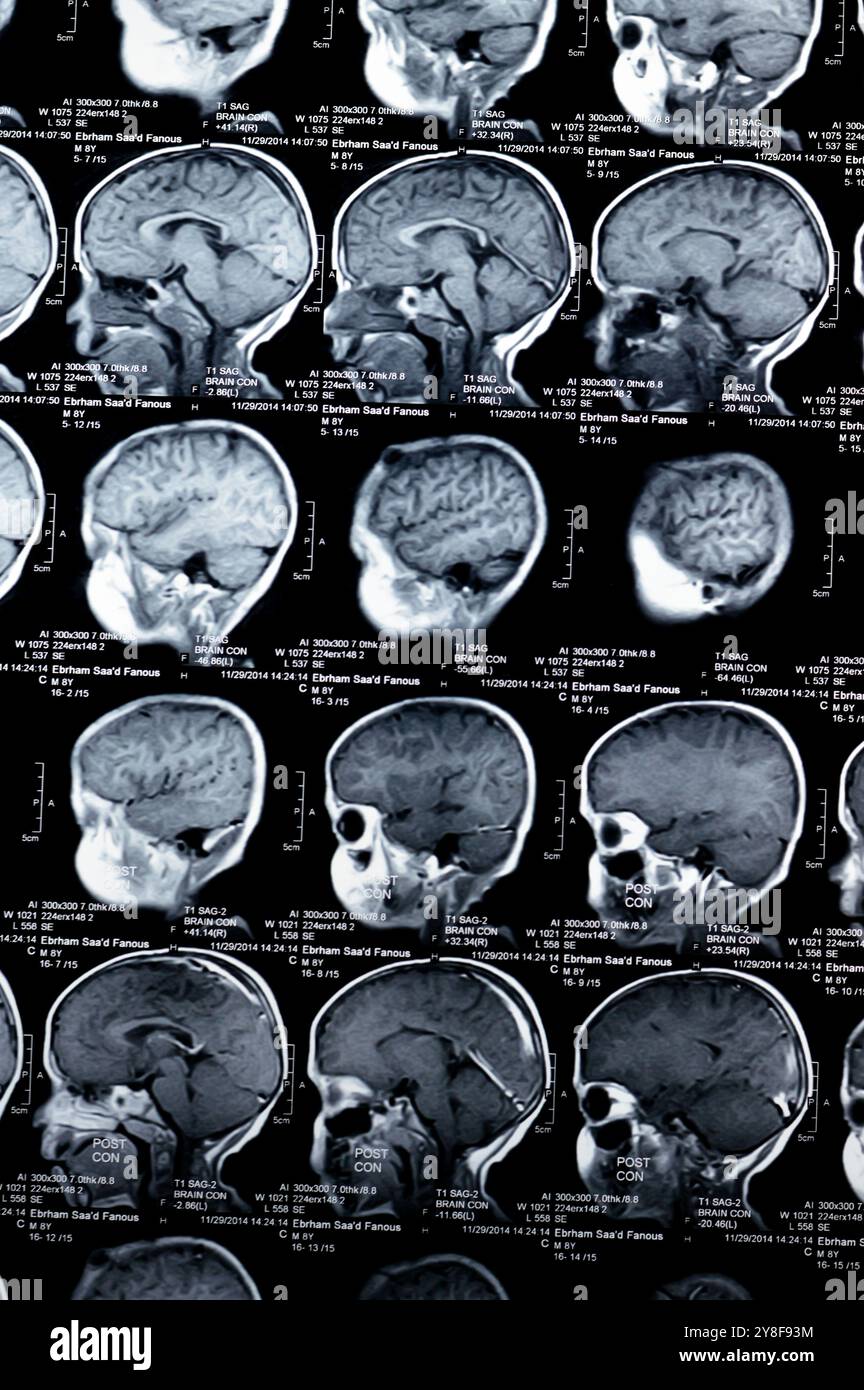 Cairo, Egypt, September 26 2024: MRI brain reveals functioning intra ...