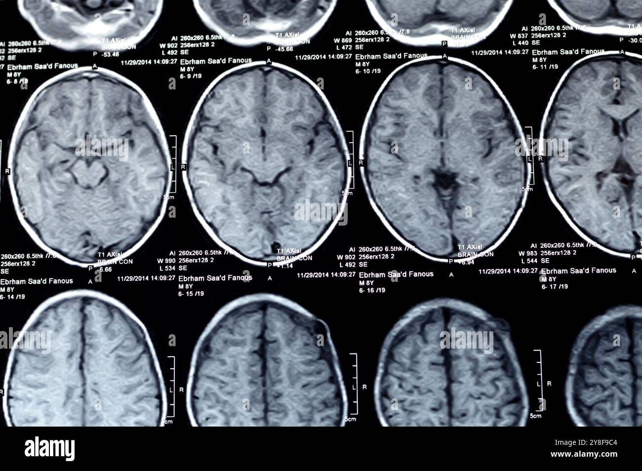 Cairo, Egypt, September 26 2024: MRI brain reveals functioning intra ...
