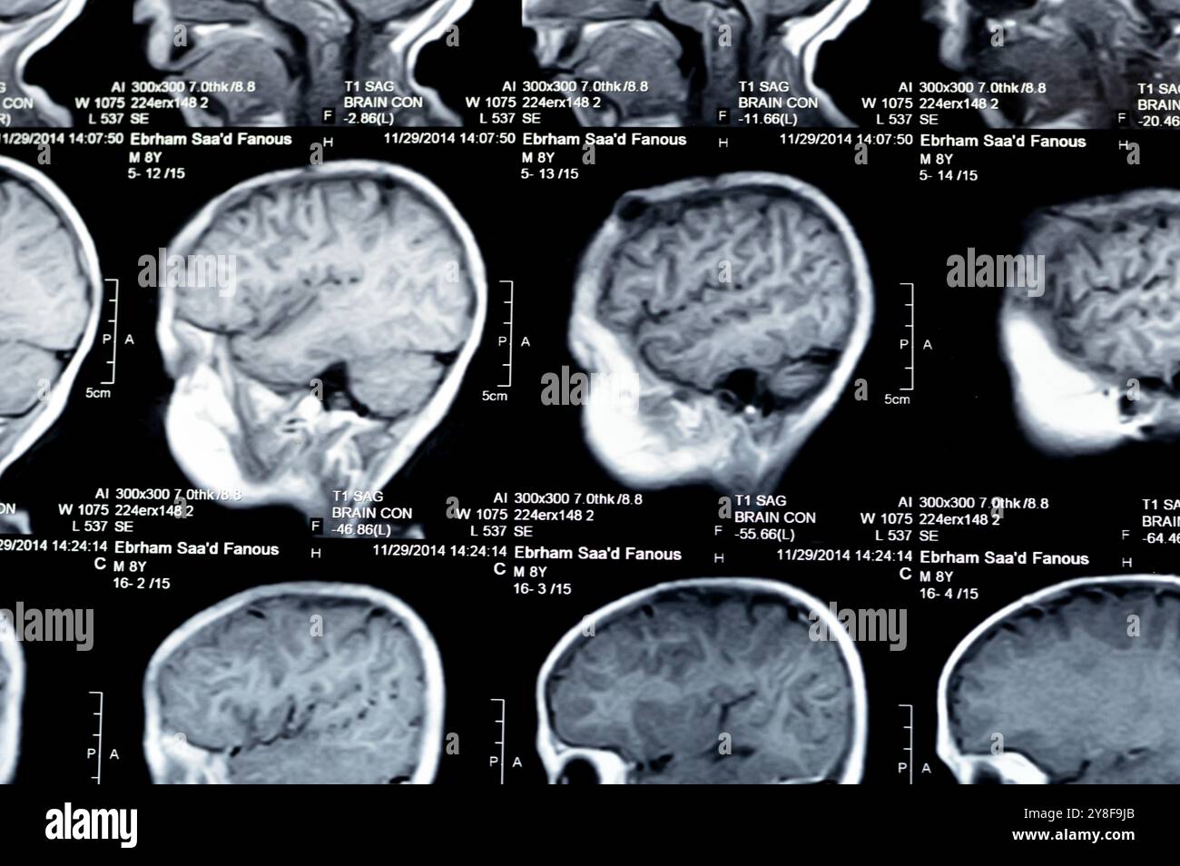 Cairo, Egypt, September 26 2024: MRI brain reveals functioning intra ...