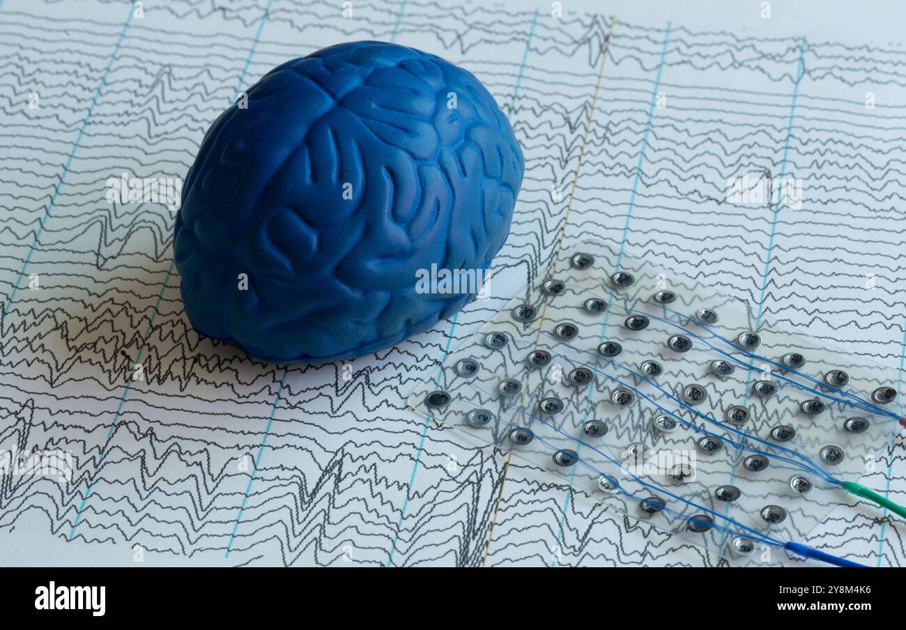 Human brain model and subdural electrode recording brain waves on from ...