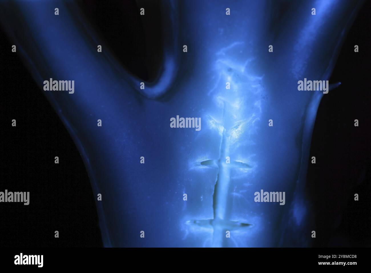 Luminol is a chemical used in forensics to detect traces of blood ...