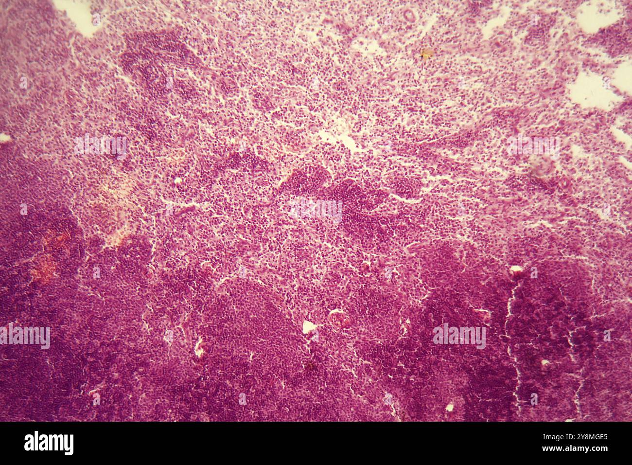 A section trough lymph node cells under the microscope Stock Photo - Alamy