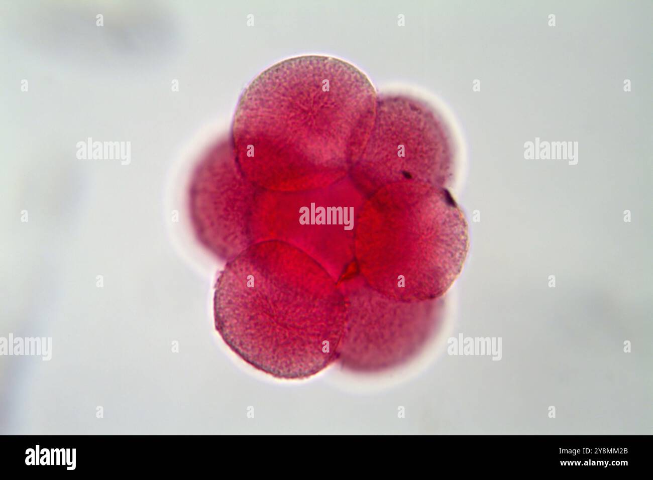 An egg cell under the microscope and after the several divisions Stock ...