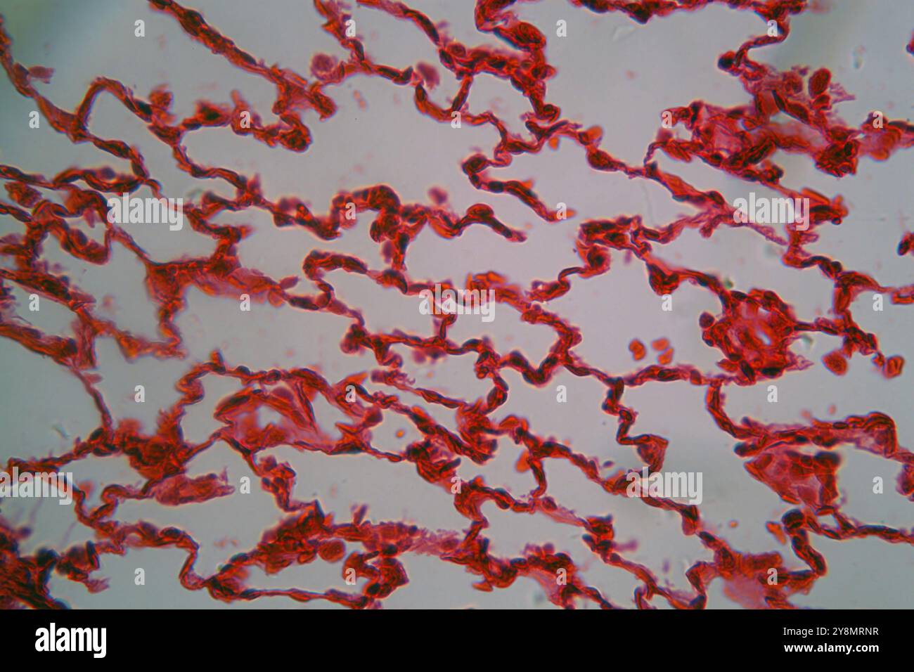 A section trough lungs cells and aveoli under the microscope Stock ...