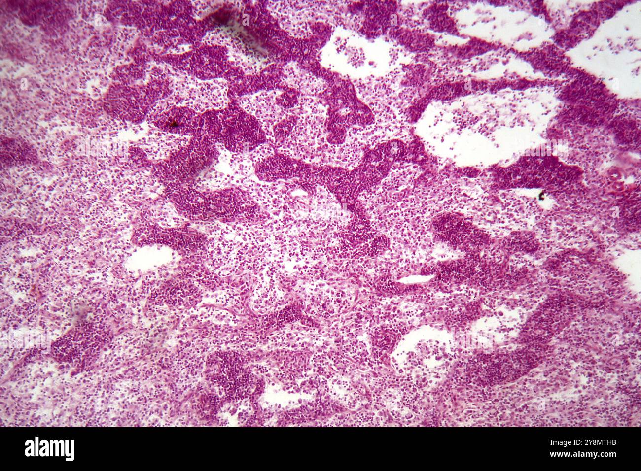 A section trough lymph node cells under the microscope Stock Photo - Alamy