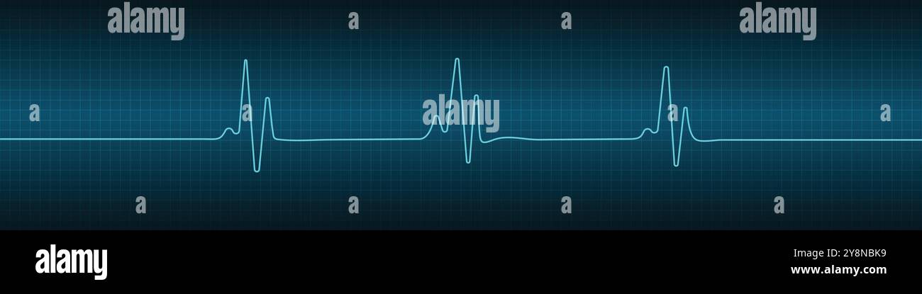 Line Art Drawing of Heart Pulse, Heartbeat Cardiogram. Heart rhythm ...