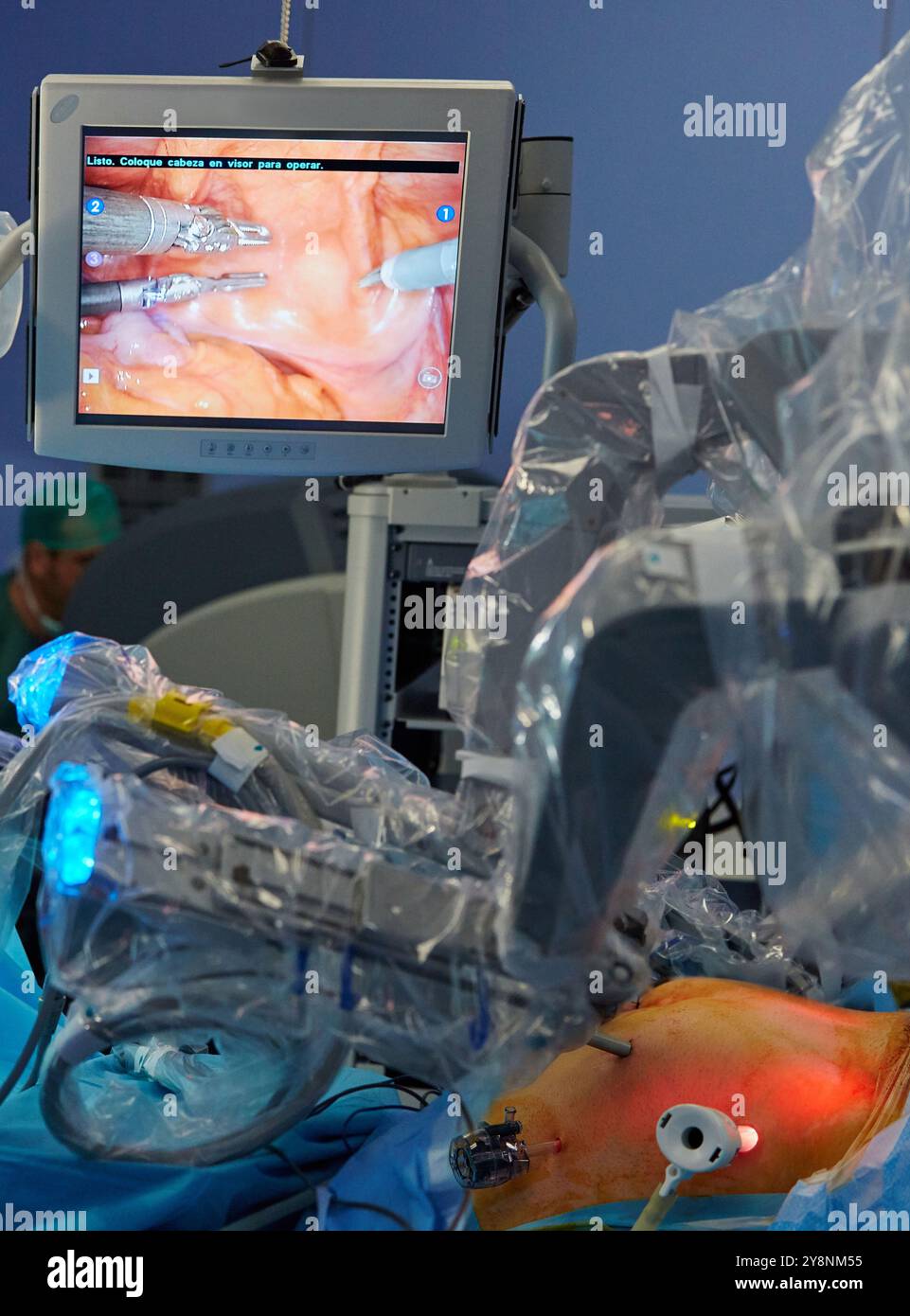 Operating room, Prostate cancer robotic surgery, Da Vinci surgical ...