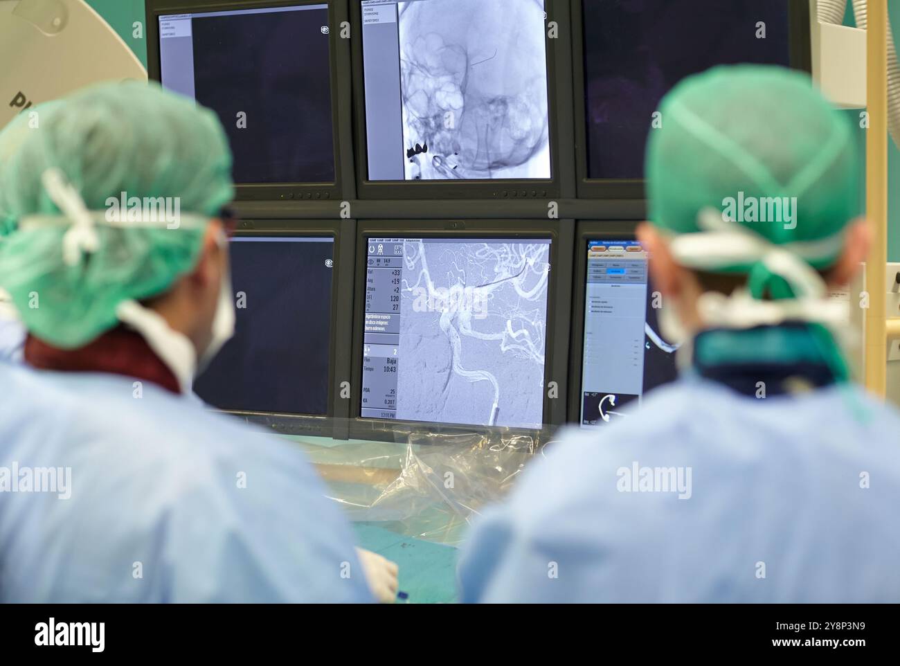 Cerebral aneurysm embolization, Willis polygone angiography ...