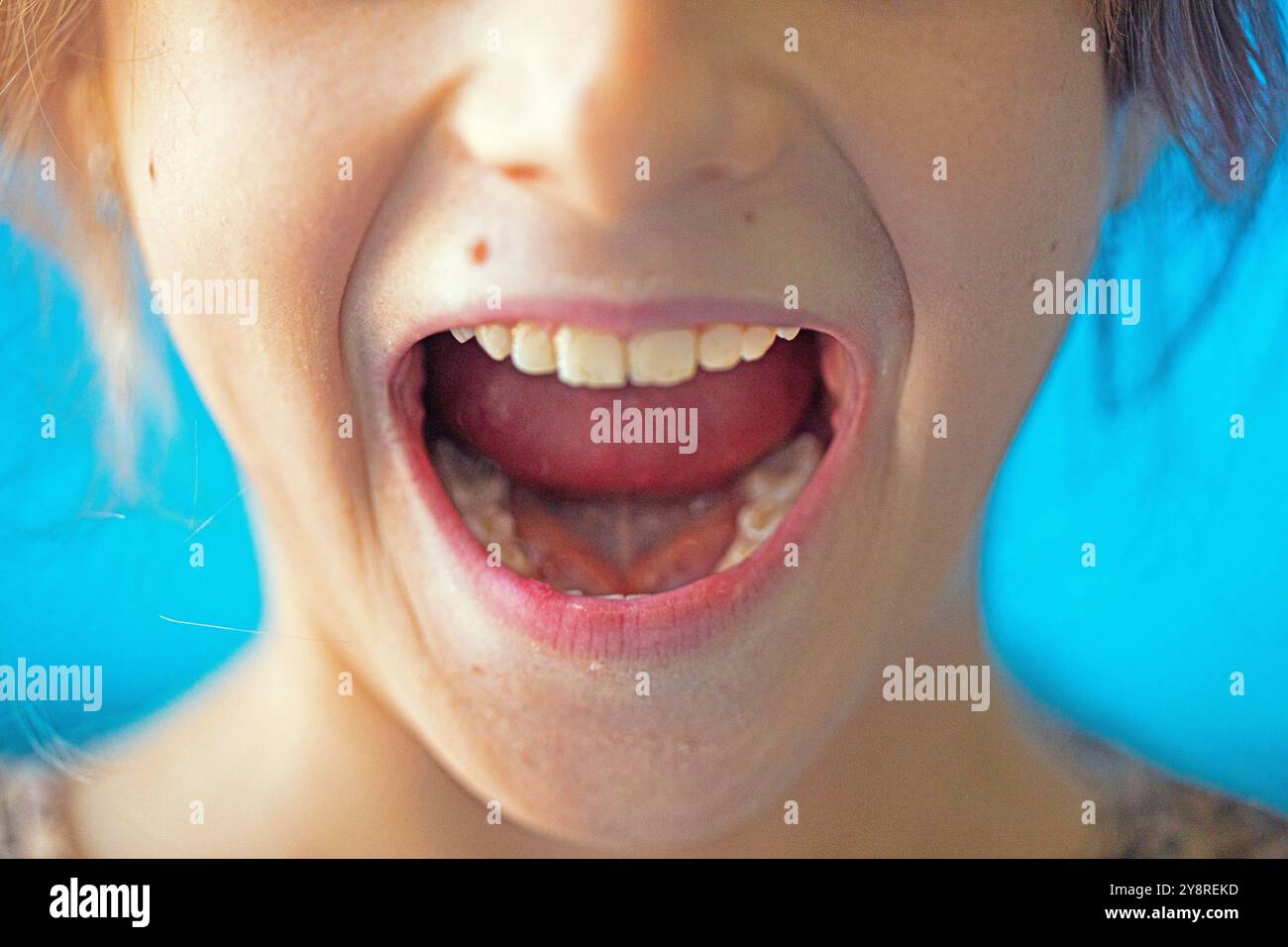 Girl opened her mouth wide. Dentist's appointment. Healthy teeth Stock ...