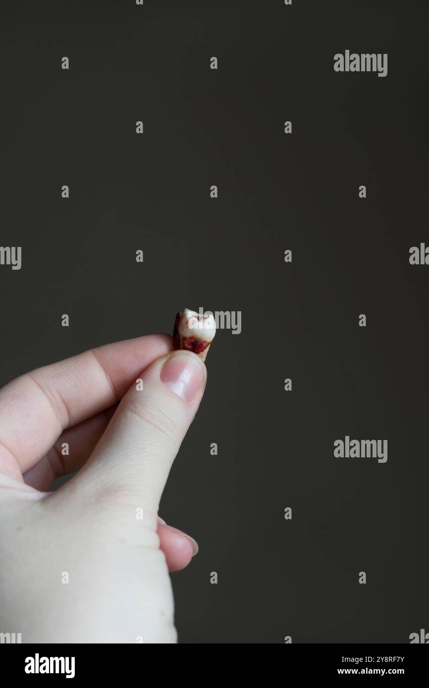 Hand holding tooth after surgery removal of a tooth with blurred ...