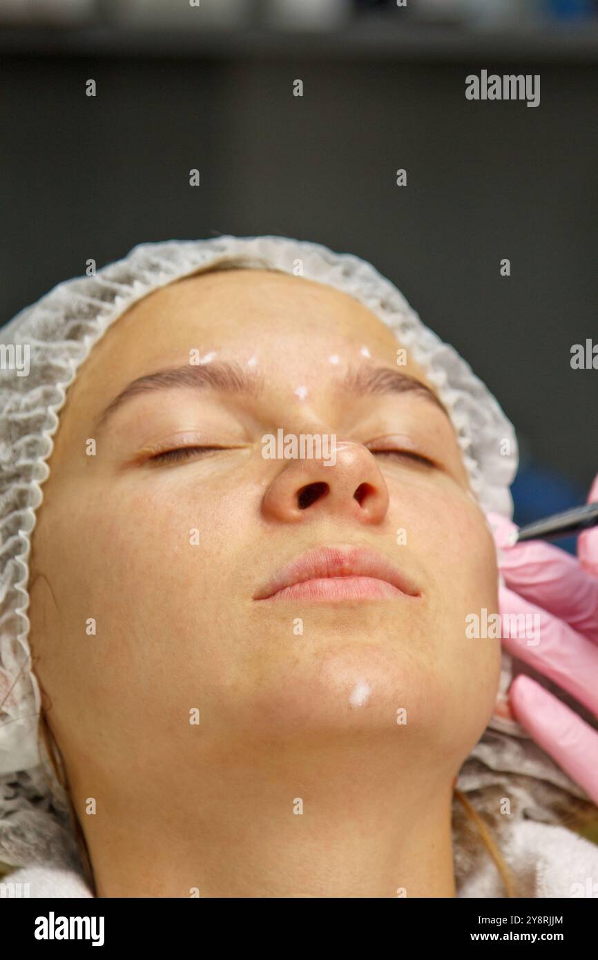 Attractive girl patient with instructions on her face for plastic ...