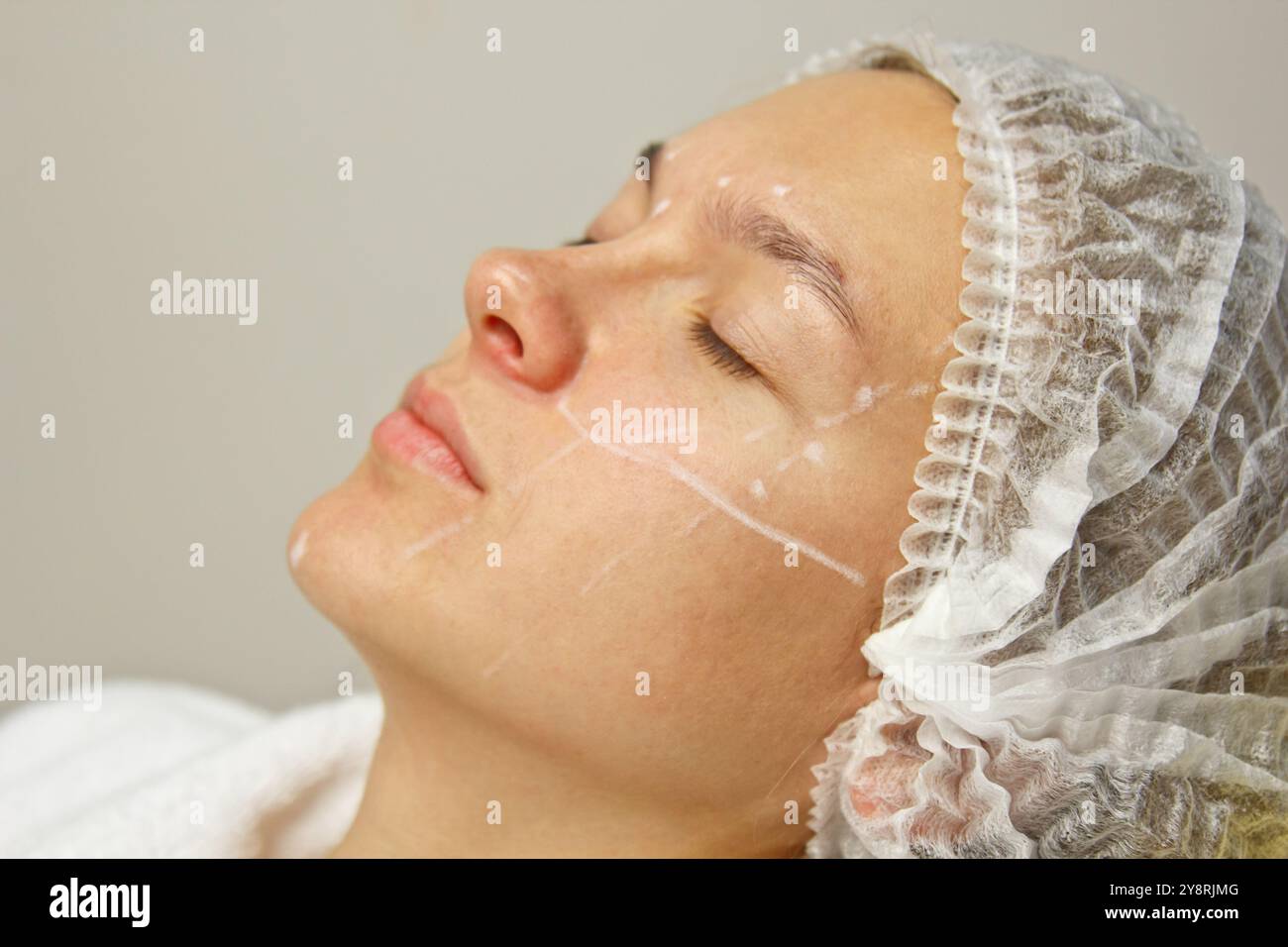 Attractive girl patient with instructions on her face for plastic ...