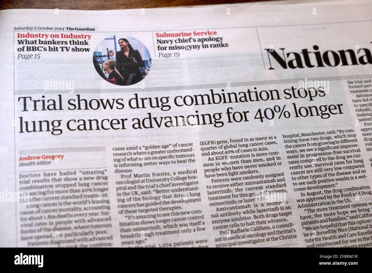 'Trial shows drug combination stops lung cancer advancing for 40% longer' Guardian newspaper ...