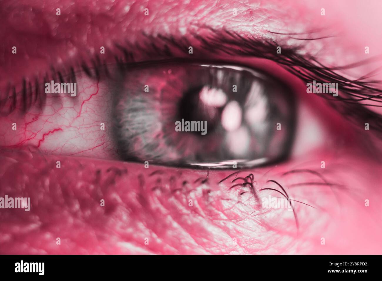 open human eye with bright red arteries close up. irritation and ...