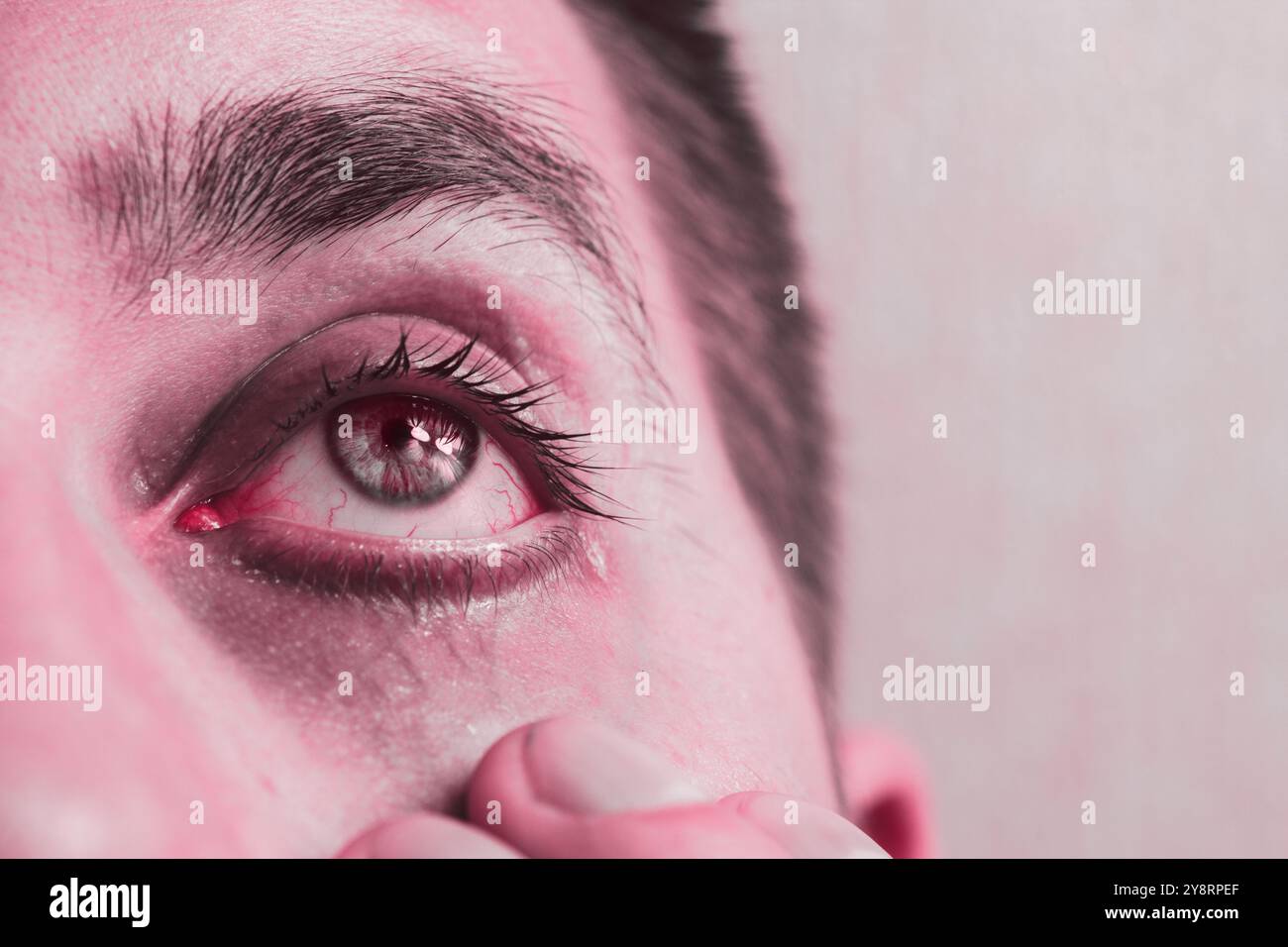 open human eye with bright red arteries close up. irritation and ...