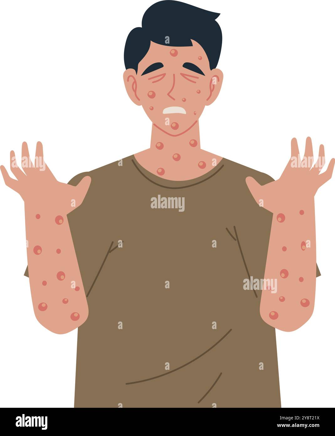 Many spots Stock Vector Images - Alamy