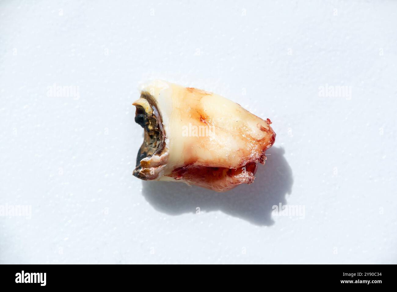 Detail of bad dead human pulled tooth on white background Stock Photo ...