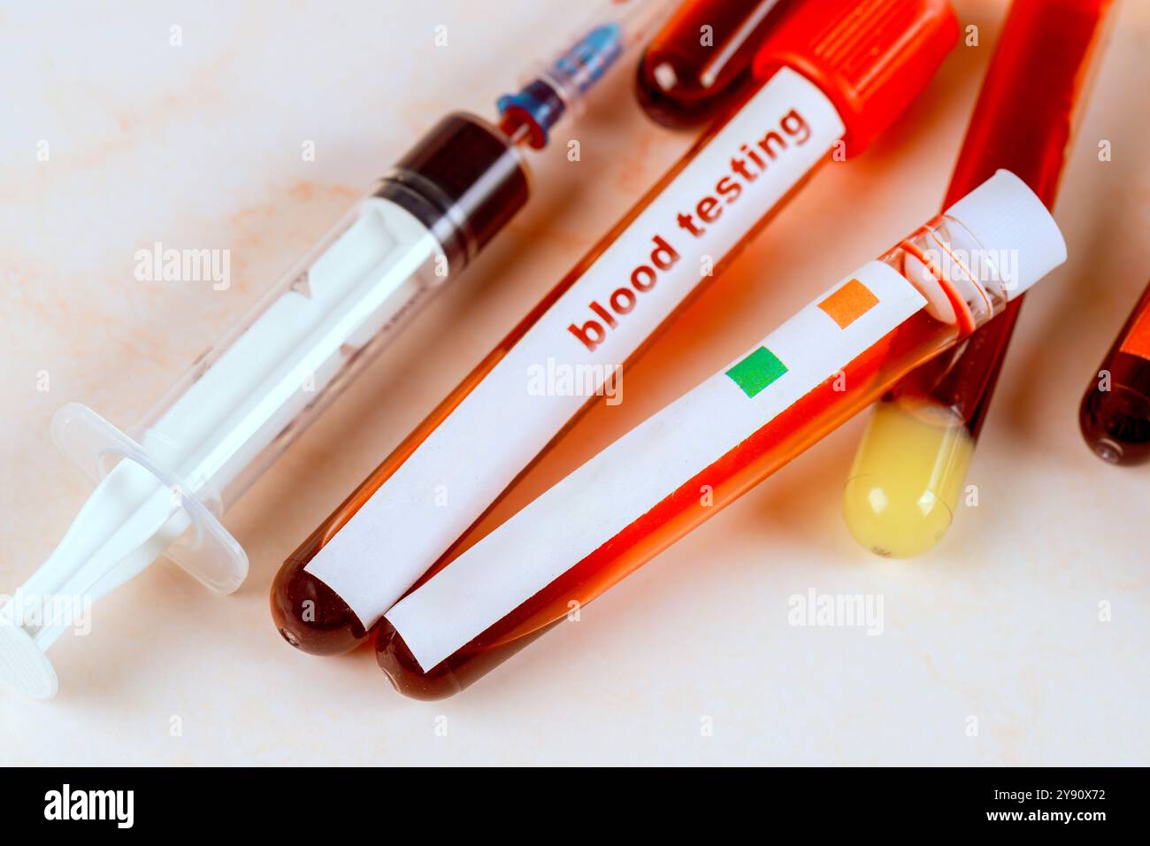 In medical laboratory, medical tubes with blood samples are used for ...