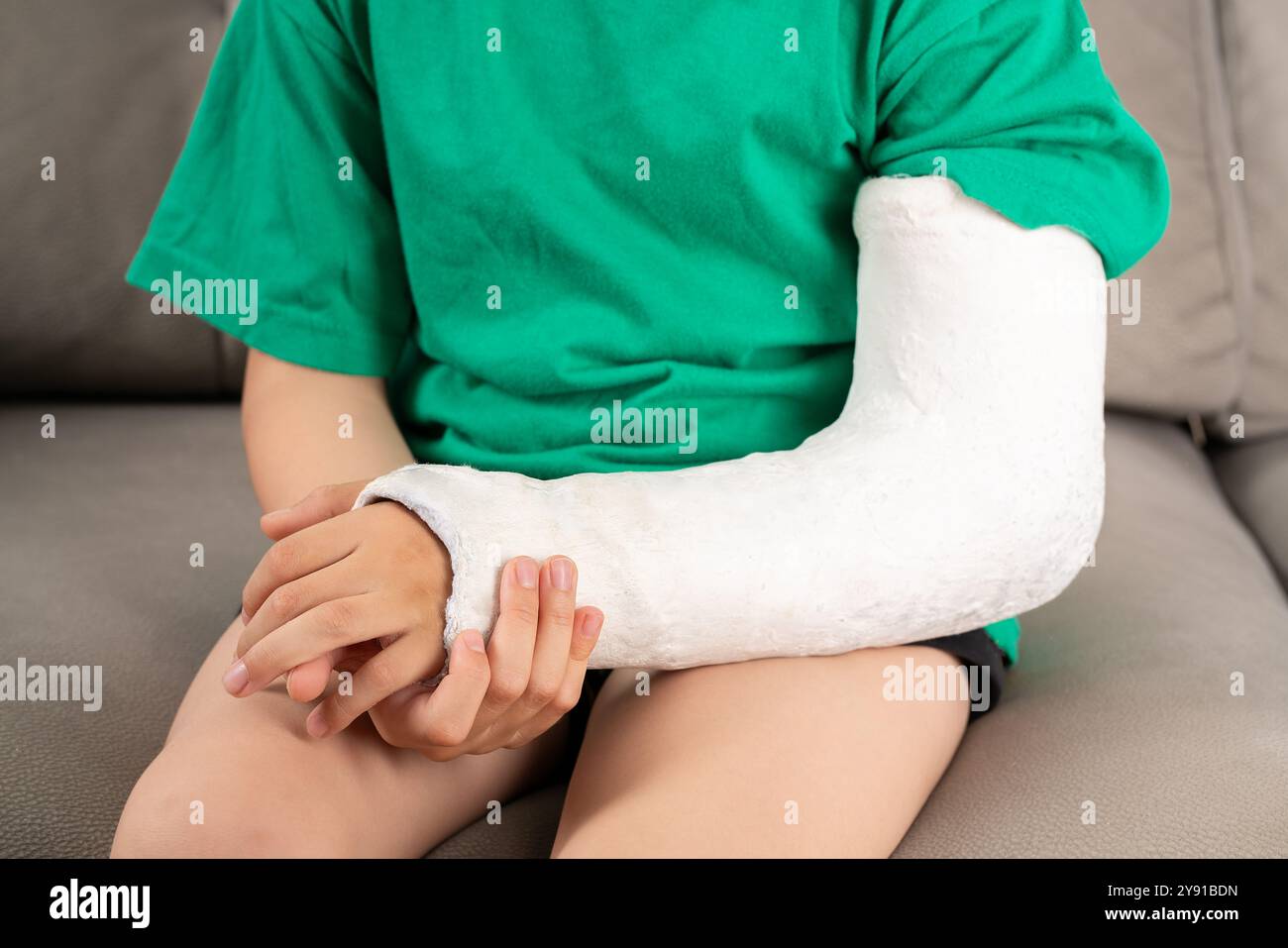 A child's arm is broken.Child with a fractured limb indoor. fracture ...