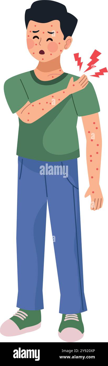 man scratching because of monkeypox disease Stock Vector Image & Art ...