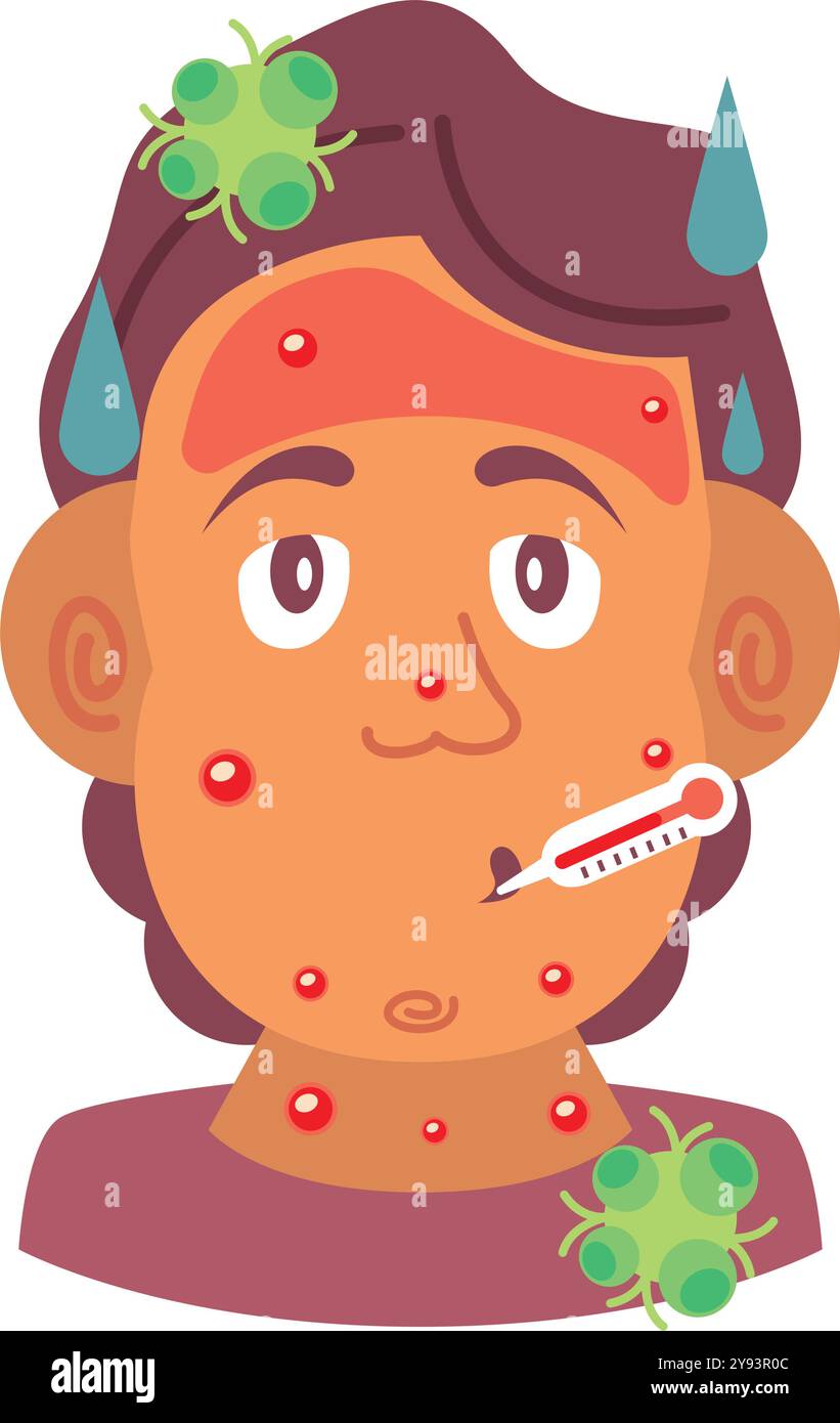 Mpox symptoms Cut Out Stock Images & Pictures - Alamy