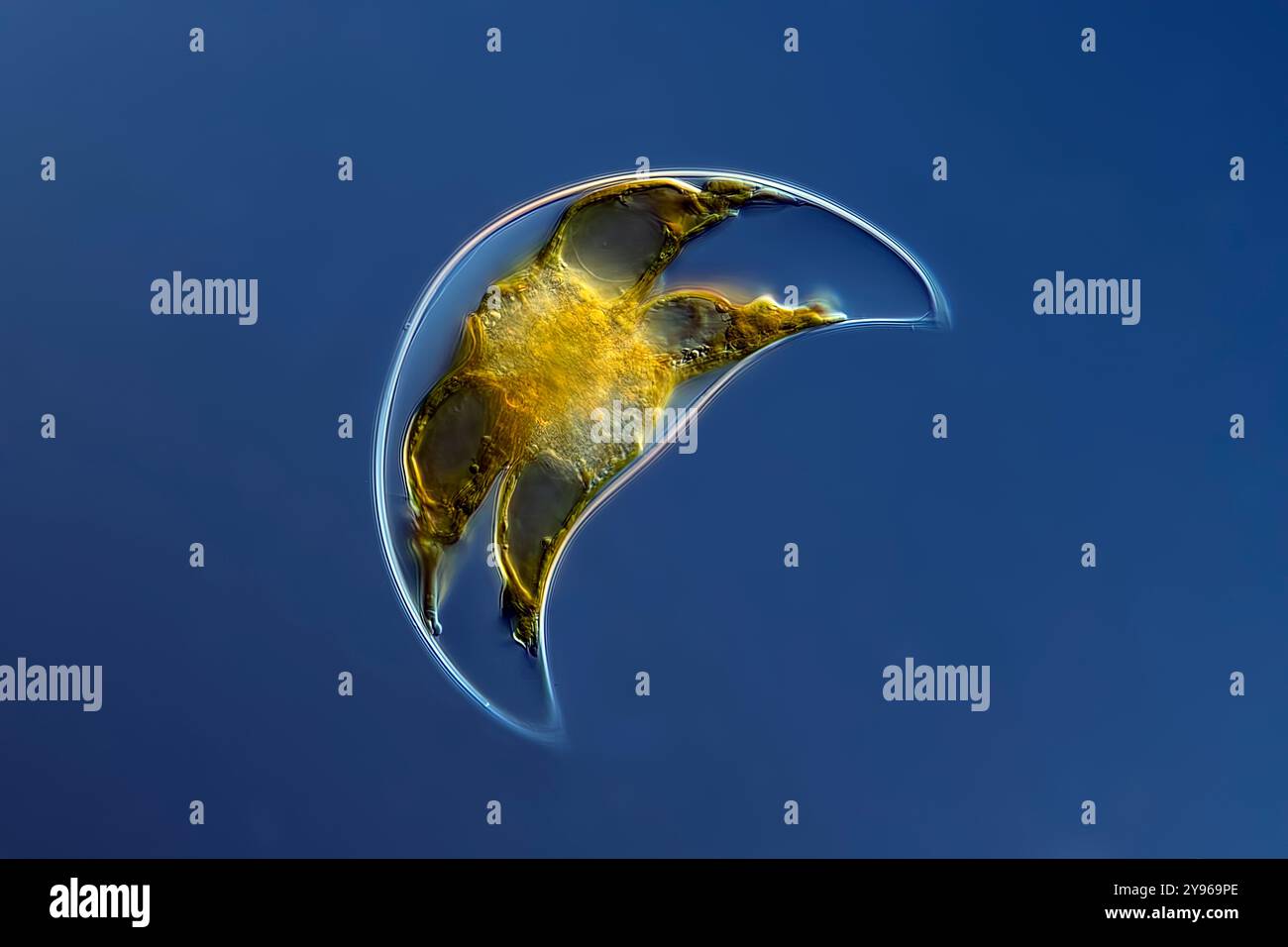 Differential interference contrast (DIC) light micrograph of Pyrocystis ...