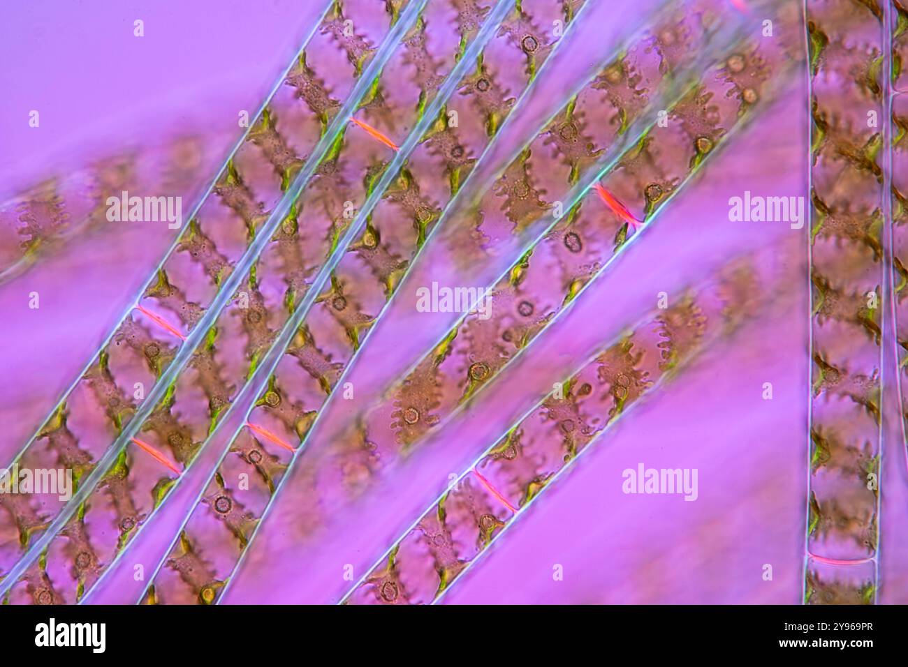 Differential interference contrast (DIC) light micrograph of Spirogyra ...