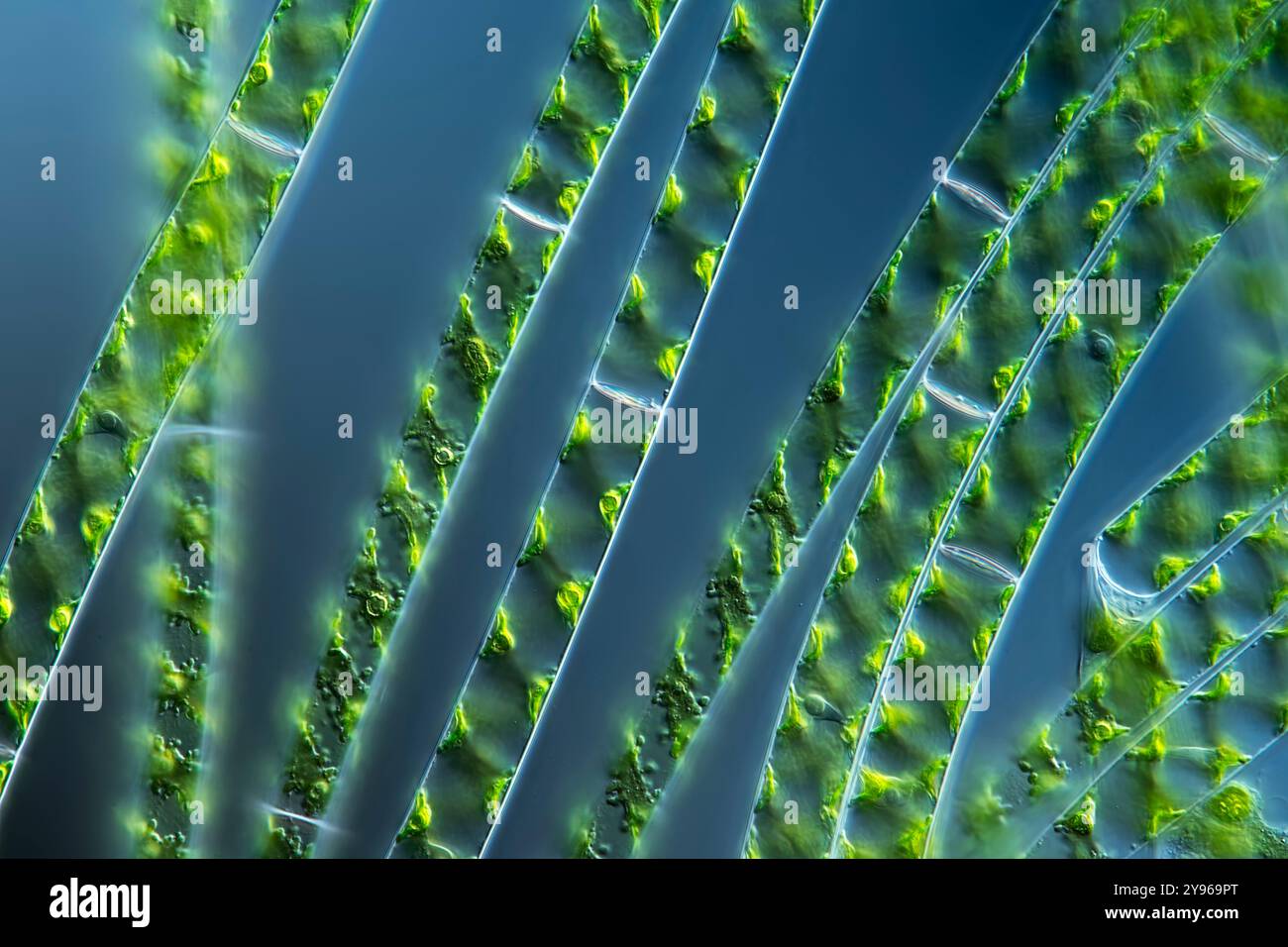 Differential interference contrast (DIC) light micrograph of Spirogyra ...