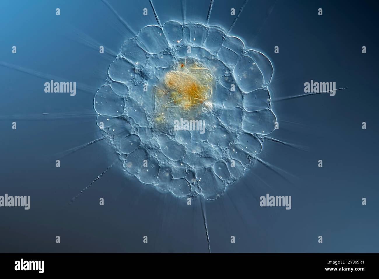 Differential interference contrast (DIC) light micrograph of a Heliozoa ...