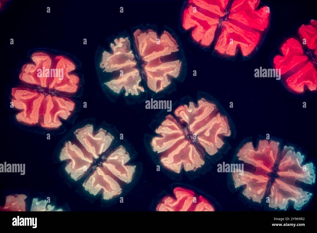 Fluorescence interference contrast (FLIC) light micrograph of ...