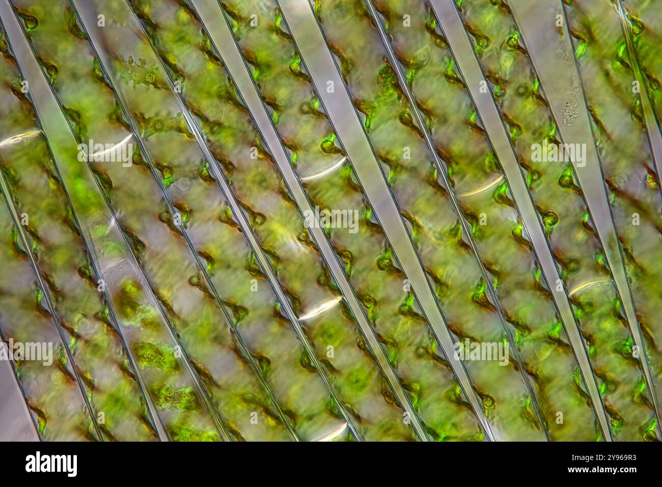 Differential interference contrast (DIC) light micrograph of Spirogyra ...